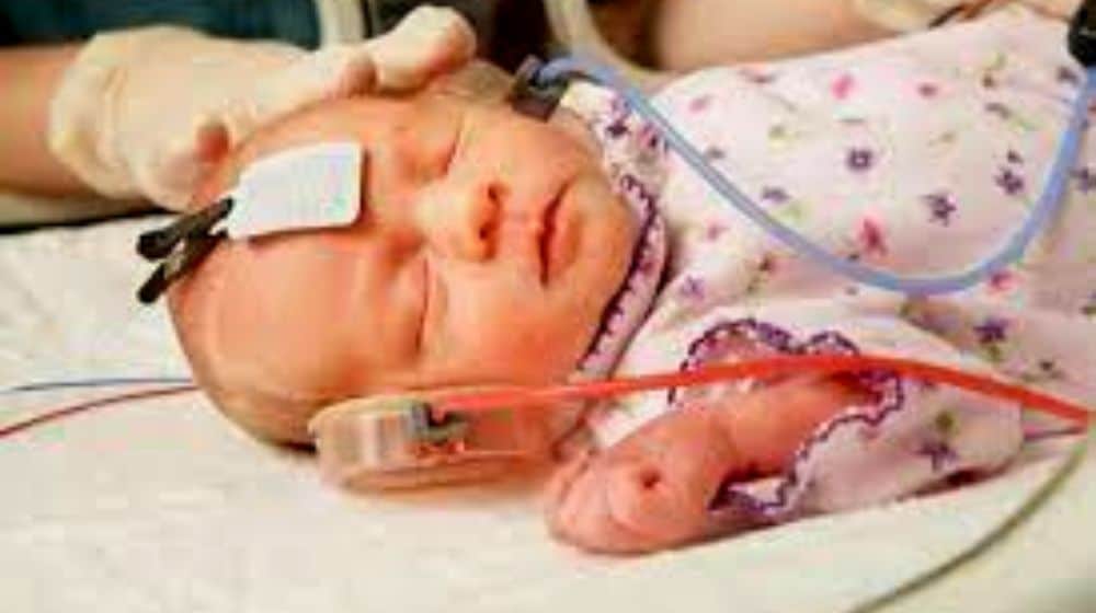 Newborn With Burnt Legs Undergoes Successful Surgery After Incubator Mishap